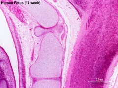 Fetal Development - 10 Weeks - Embryology