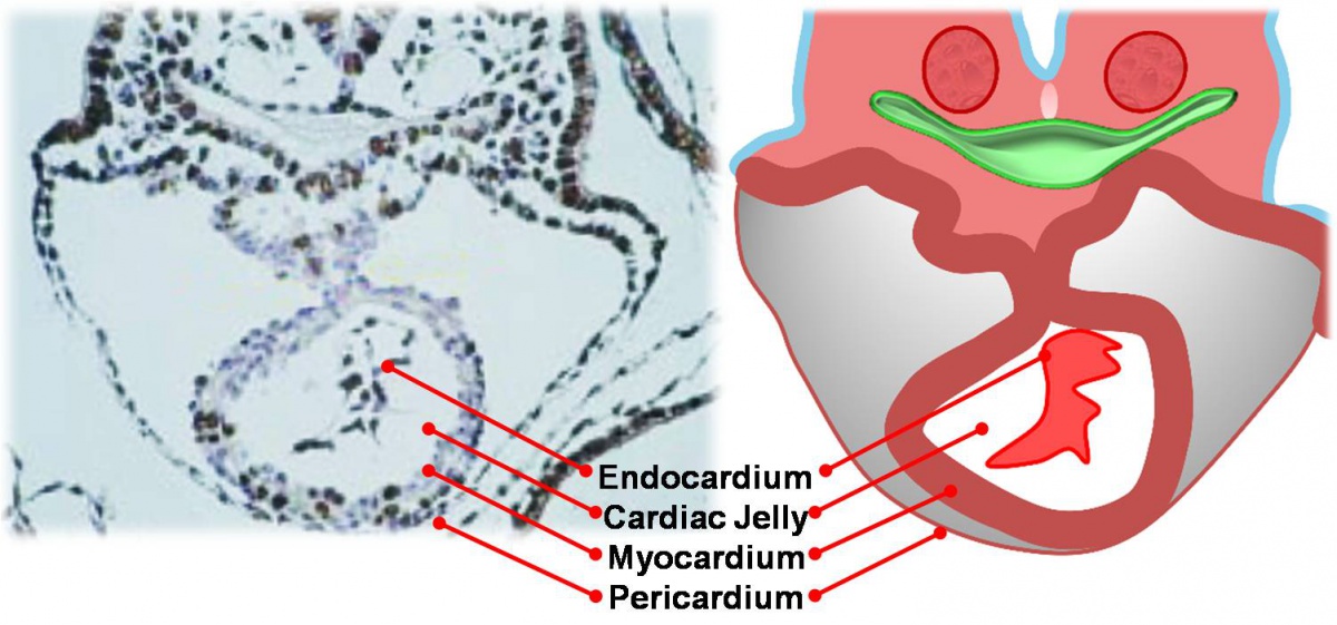 Intermediate - Primordial Heart Tube - Embryology