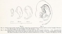 Hearing - Outer Ear Development - Embryology