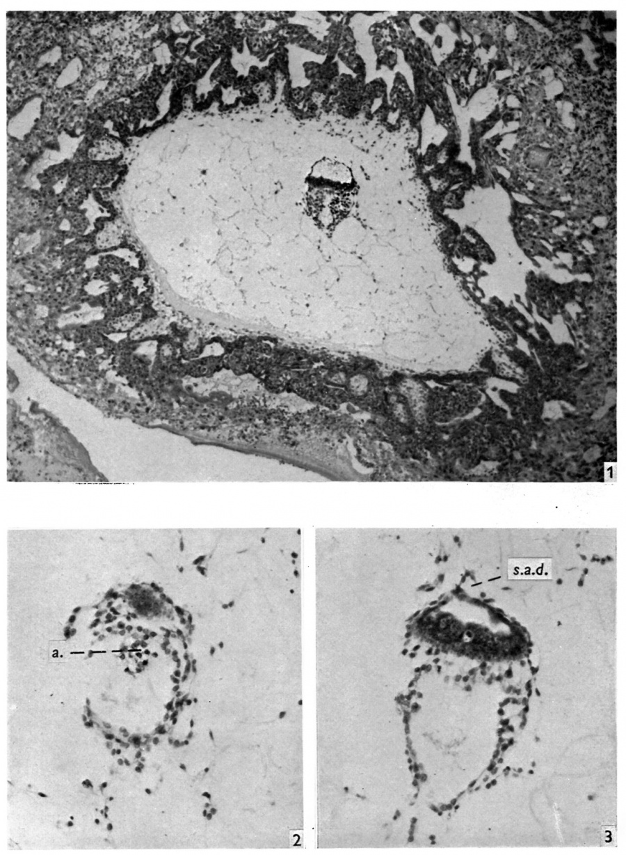 Paper - A presomite human embryo showing an early stage of the ...
