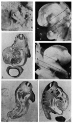 Paper - A study of a 7 mm human embryo with special reference to its ...