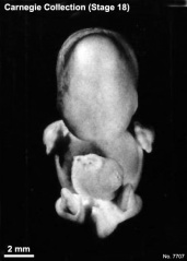 Category:Carnegie Embryo 7707 - Embryology