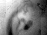 Abnormal Chick Heart Movie 1 - Embryology