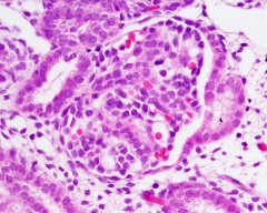 Lecture - Renal Development - Embryology