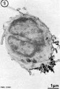 Immune System - Antibody Development - Embryology