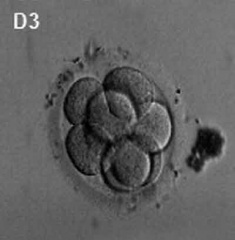 Category:Carnegie Stage 2 - Embryology