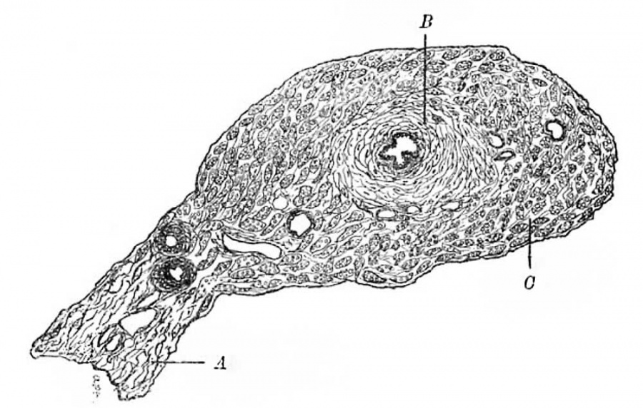 Paper - Tubal gestation - A pathological study - Embryology