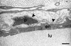 HM Practical - Blood Vessel Histology - Embryology