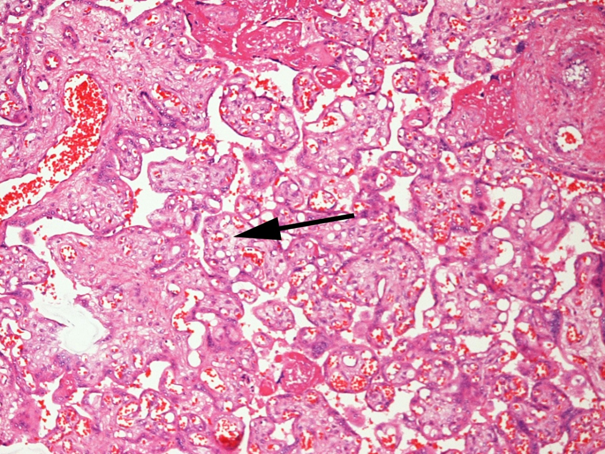 File:Placenta histology 005.jpg - Embryology
