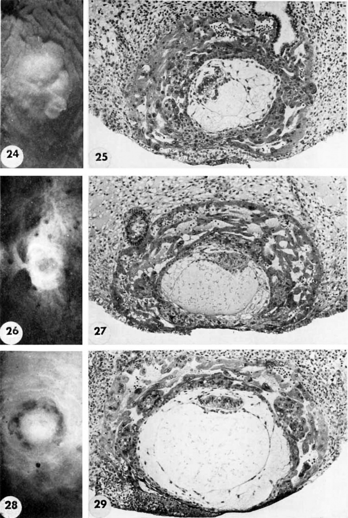 Paper - A description of 34 human ova within the first 17 days of ...