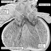 Mouse Heart - Embryology