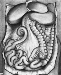 Category:Intestine - Embryology