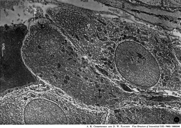 Testis Development - Embryology