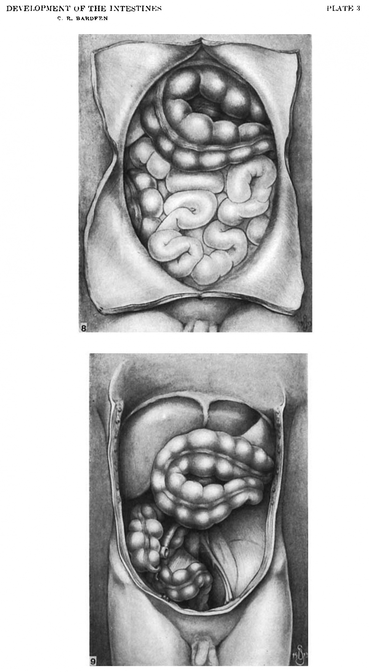 Paper - The critical period in the development of the intestines (1914 ...