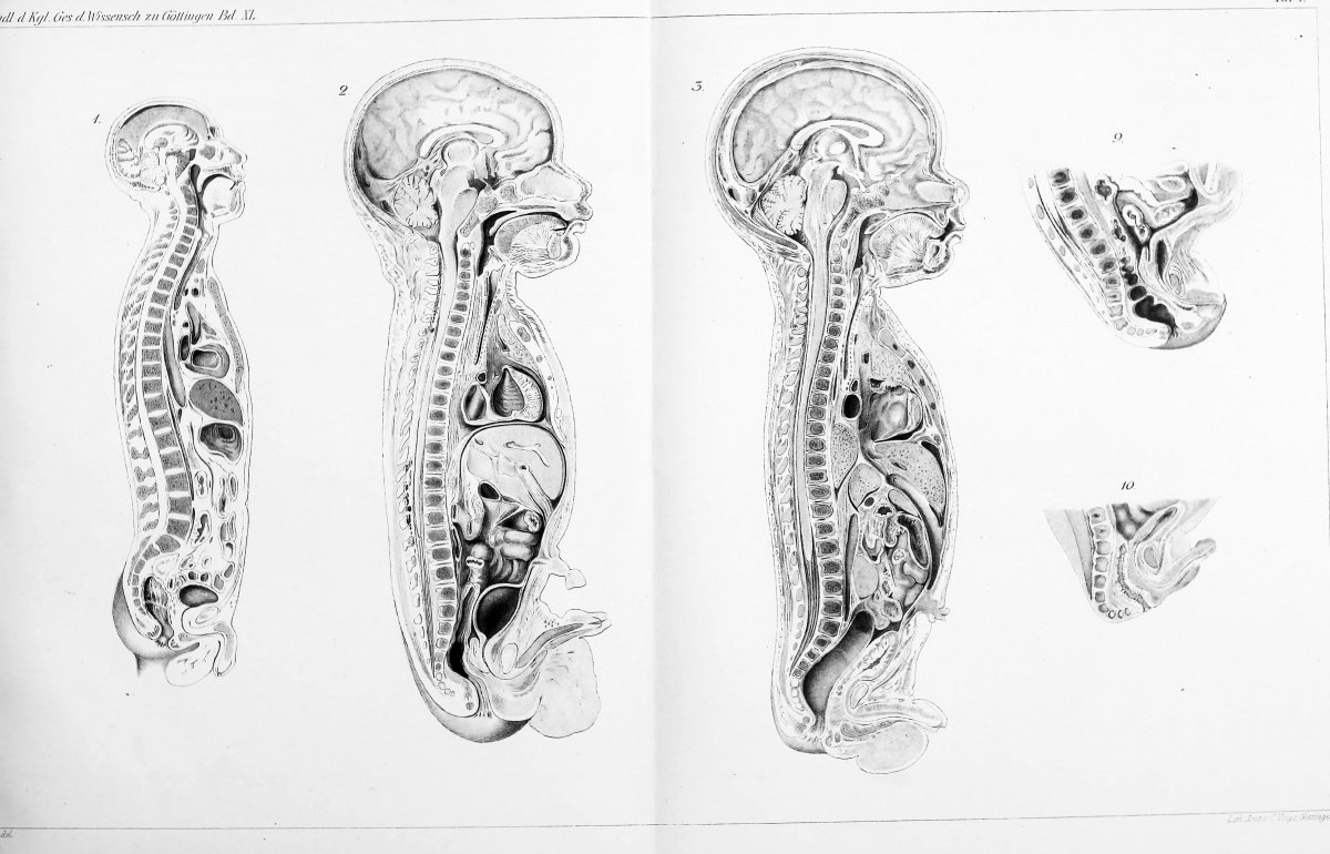 Book - Human embryos of different ages examined in median sections - a ...