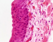 ANAT2241 Covering and Lining Epithelia - Embryology