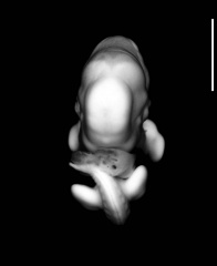 Carnegie stage 15 - Embryology
