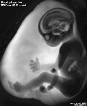 P - Embryology