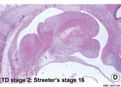 Tongue Development - Embryology