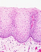 ANAT2241 Covering and Lining Epithelia - Embryology