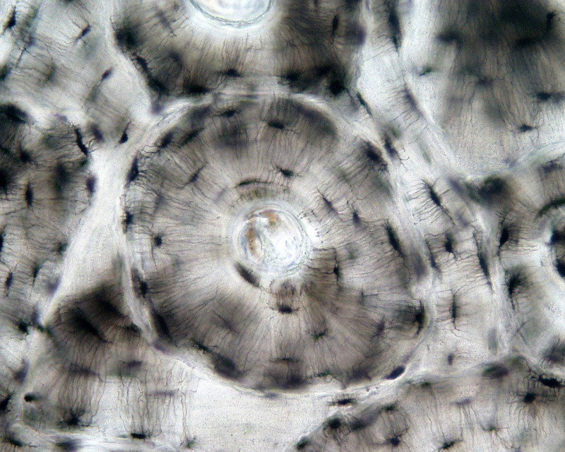 Bone Histology - Embryology