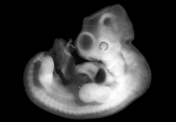 Carnegie stage 16 - Embryology