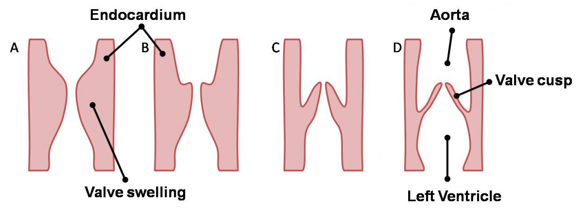 Intermediate - Heart Valves - Embryology