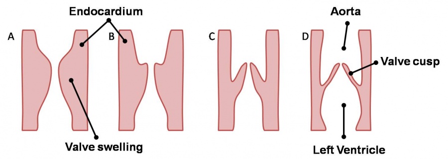 Advanced - Valve Development - Embryology