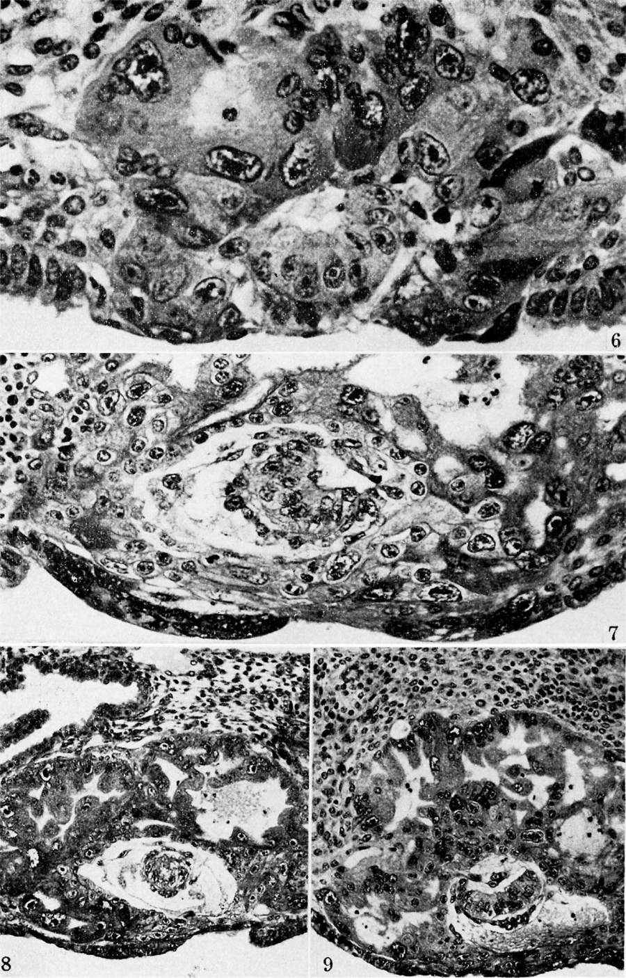 Paper - On the development of the amnion and exocoelomic membrane in ...
