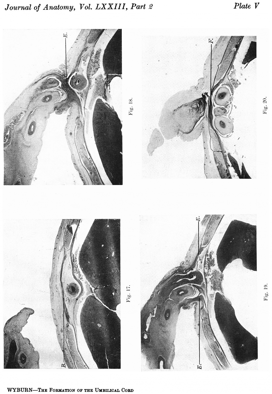 Paper - The formation of the umbilical cord and the umbilical region of ...
