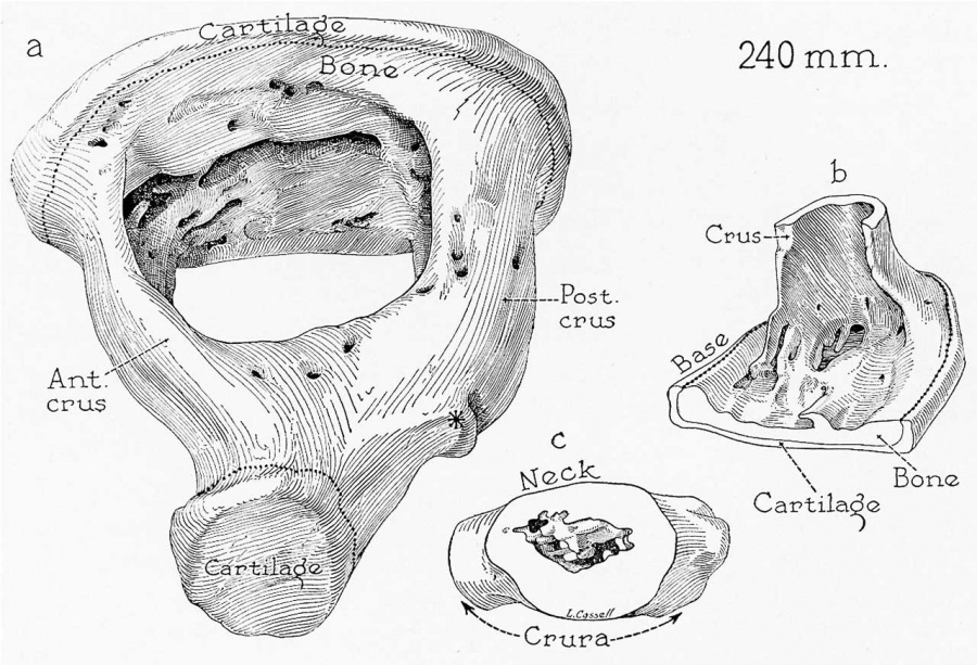 Paper - Stapes, fissula ante fenestram and associated structures in man ...