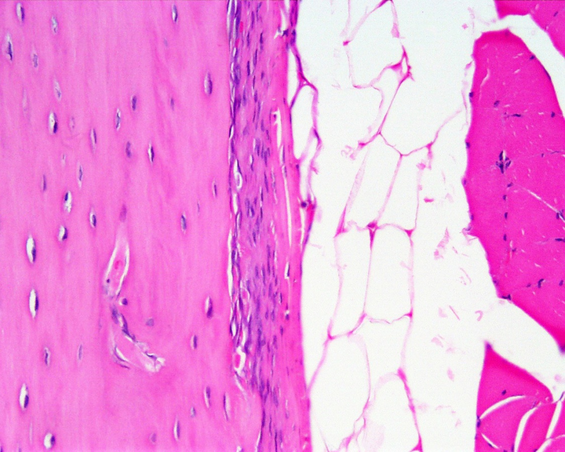 File:Bone histology 021.jpg - Embryology