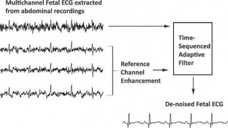 Electrocardiogram - Embryology