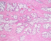 Prostate Development - Embryology