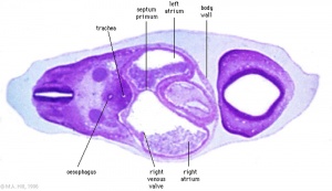 Sensory - Smell Development - Embryology