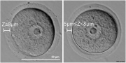 Zona pellucida - Embryology