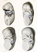 Hearing - Outer Ear Development - Embryology