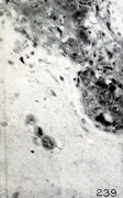 Placenta - Cord - Embryology