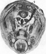 Paper - A morphological study of testicular descent - Embryology