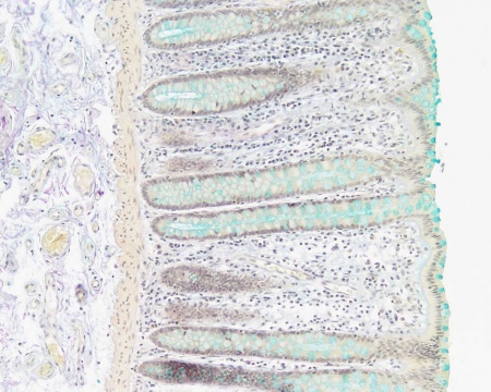Gastrointestinal Tract - Colon Histology - Embryology