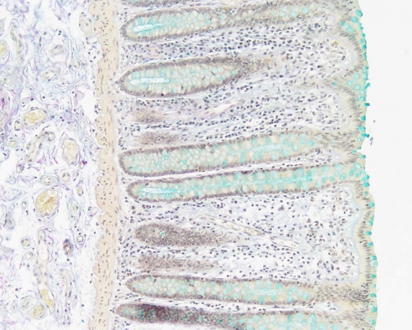 Gastrointestinal Tract - Colon Histology - Embryology