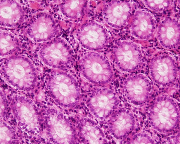 Gastrointestinal Tract - Colon Histology - Embryology