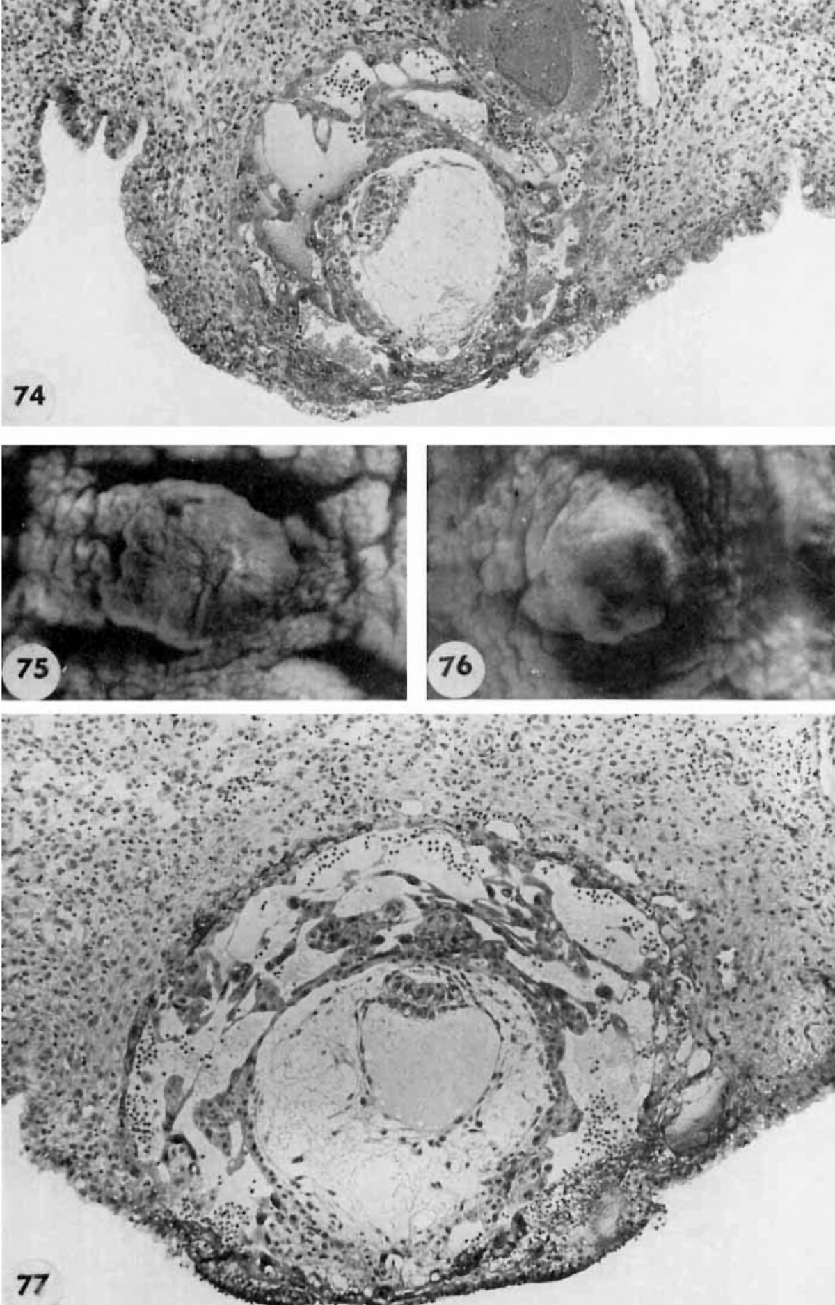 Paper - A description of 34 human ova within the first 17 days of ...
