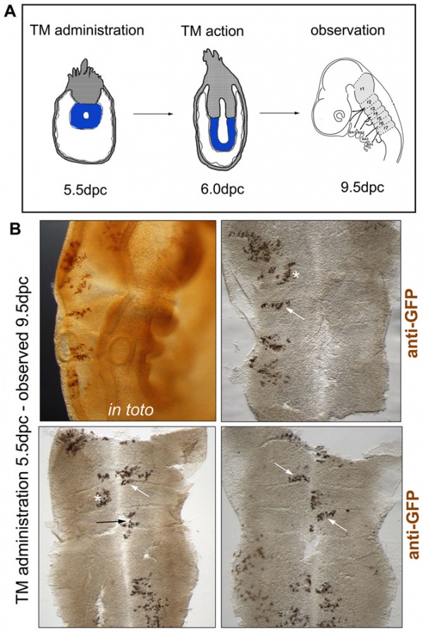 Neural - Rhombencephalon Development - Embryology