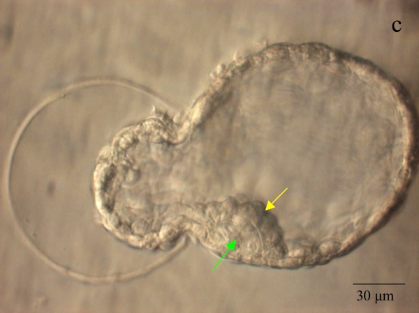 Blastocyst Development - Embryology