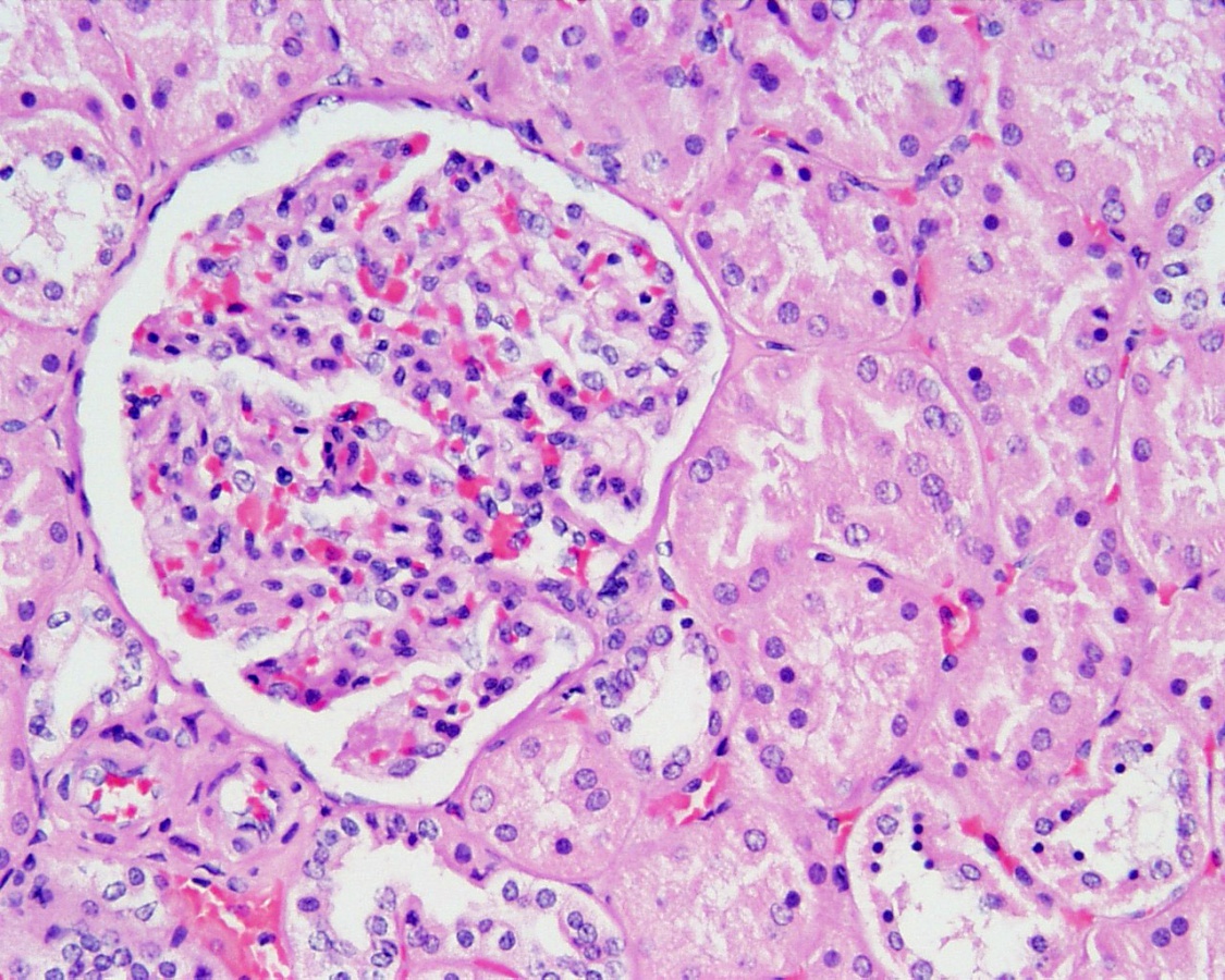 File:Renal histology 02.jpg - Embryology