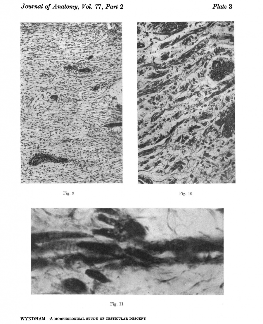 Paper - A morphological study of testicular descent - Embryology