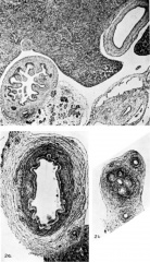 Category:Gallbladder - Embryology