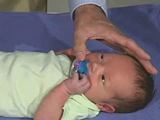 Neural Exam - Newborn tone - popliteal angle - Embryology