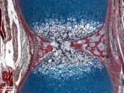 Bone Histology - Embryology